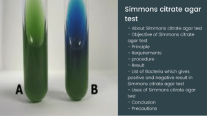 Oxidase Test - Definition, Principle, Procedure, Result, Application ...
