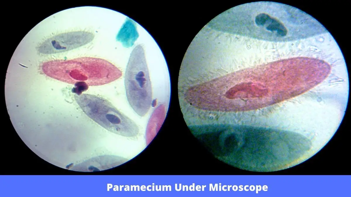 Paramecium Under Microscope Labeled The Natural Habitation And