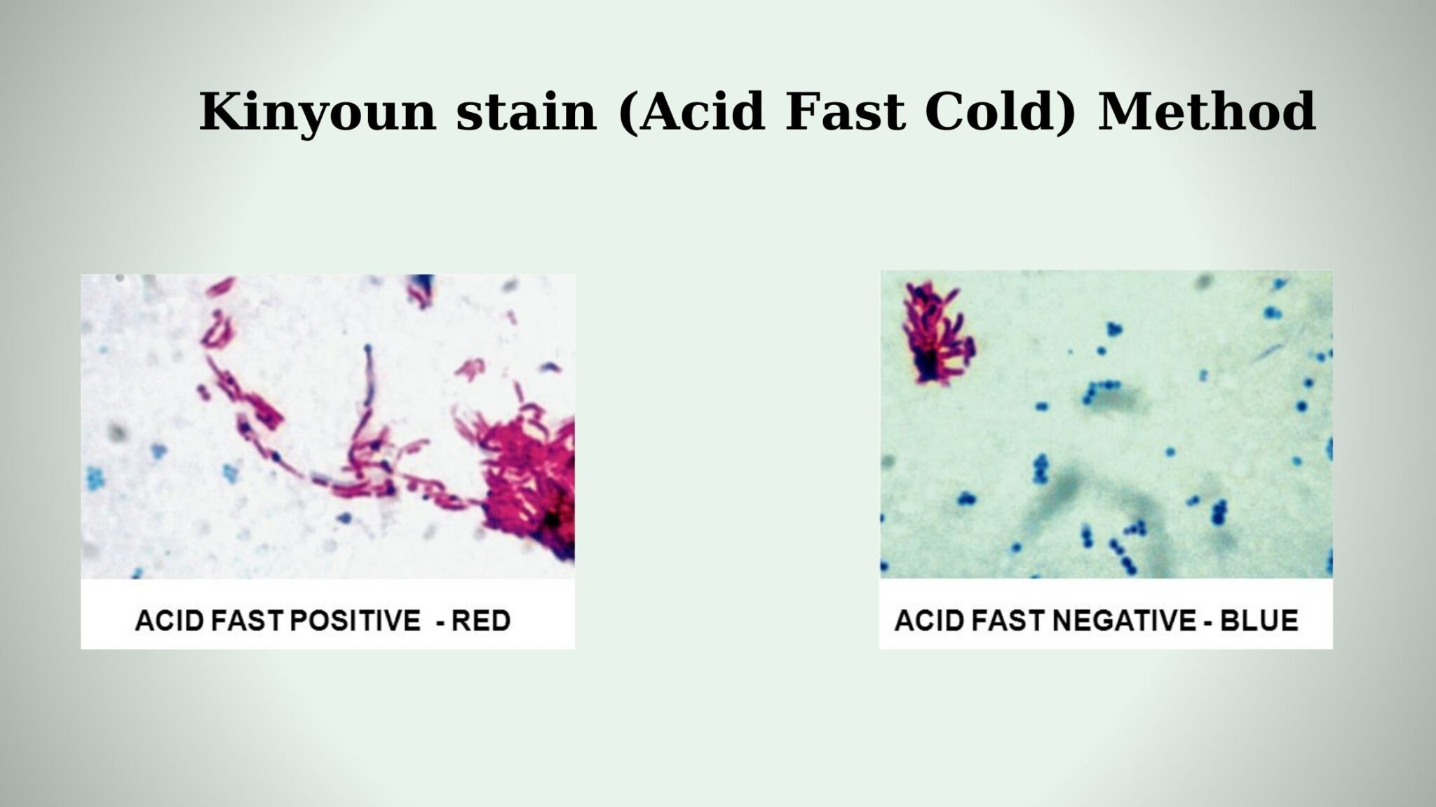 Negative Staining - Principle, Procedure, Result - Biology Notes Online