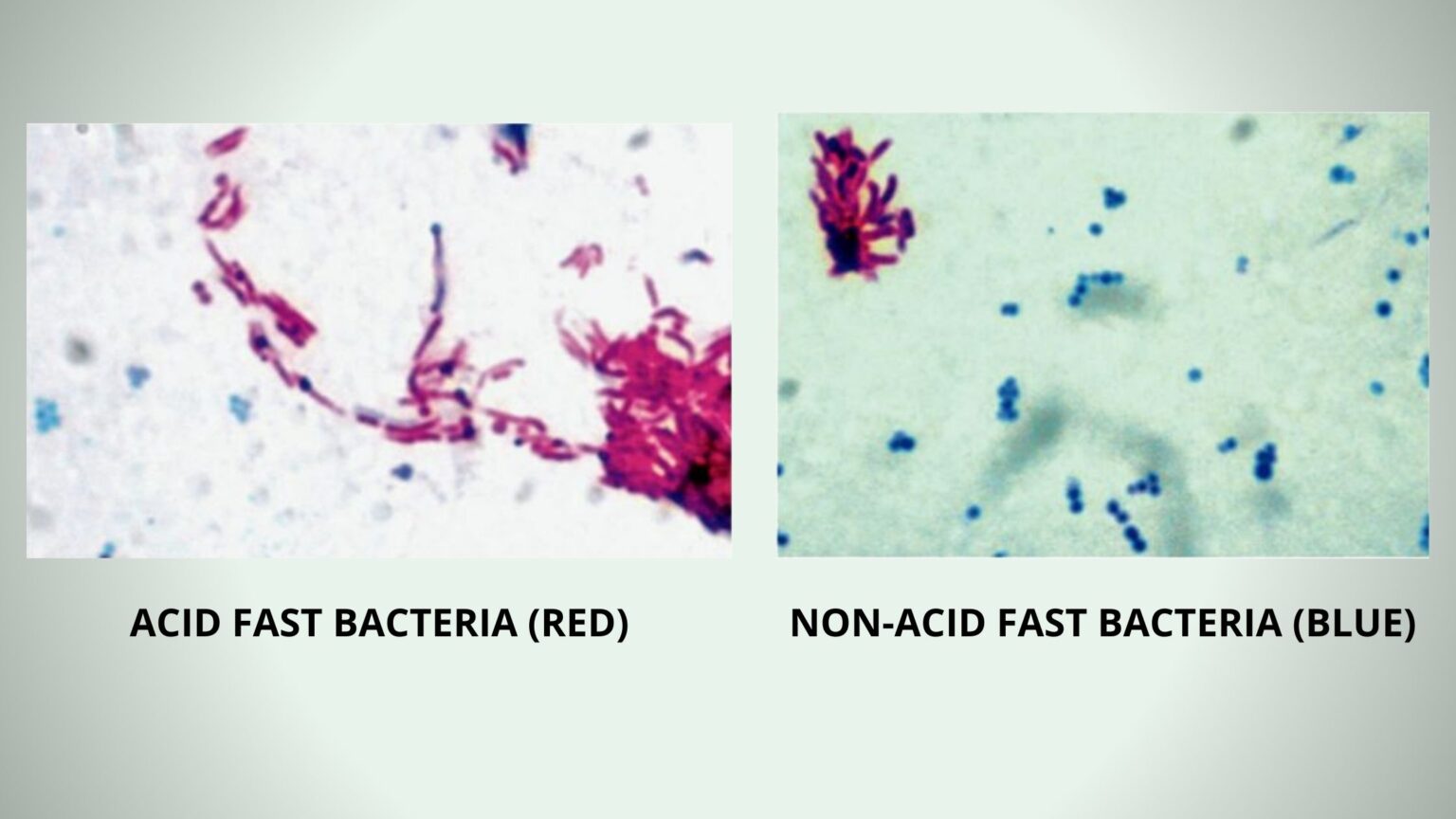 Kinyoun stain (Acid Fast Cold) Method: Principle, Procedure, Result ...