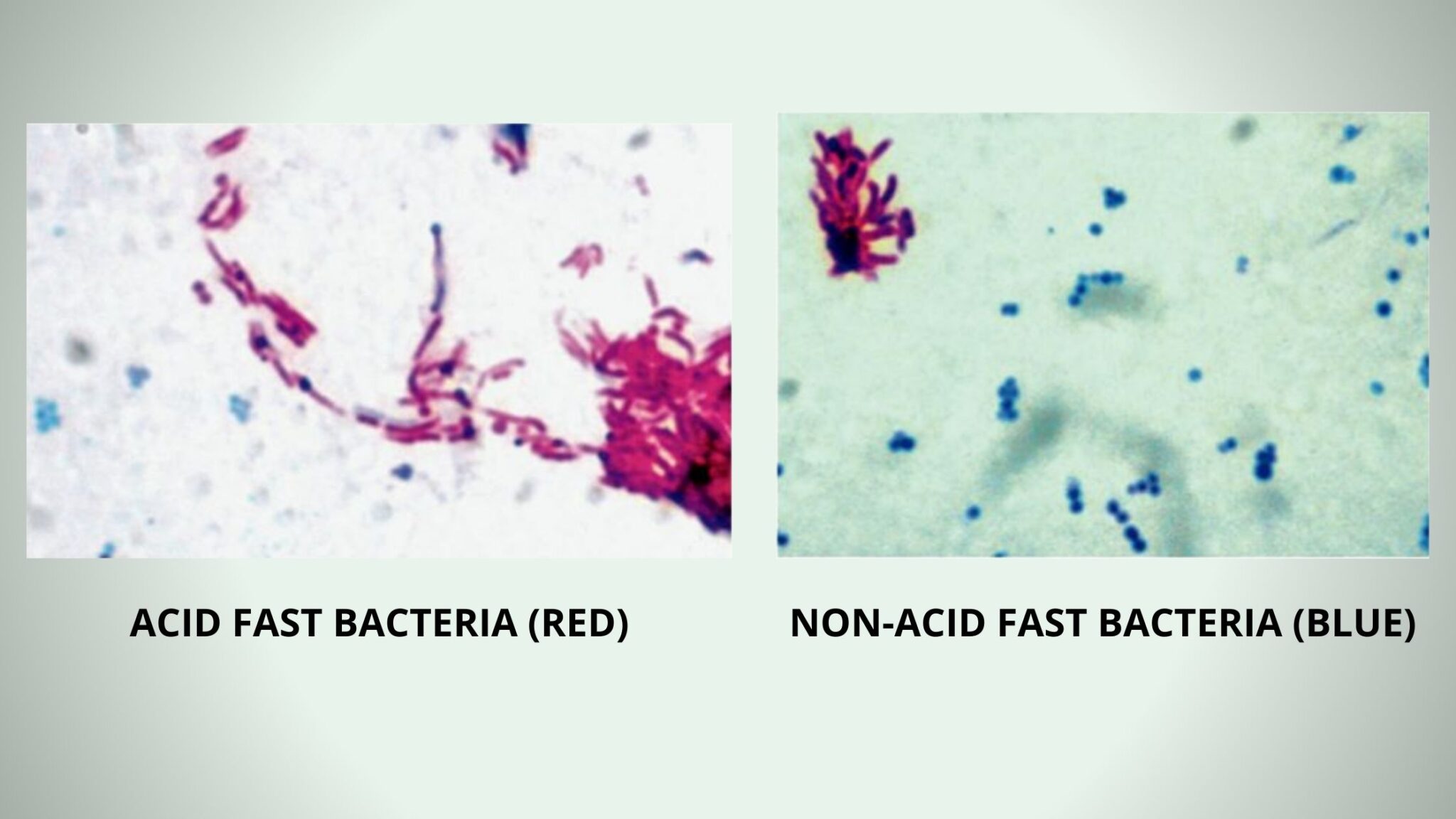 Kinyoun stain (Acid Fast Cold) Method: Principle, Procedure, Result ...