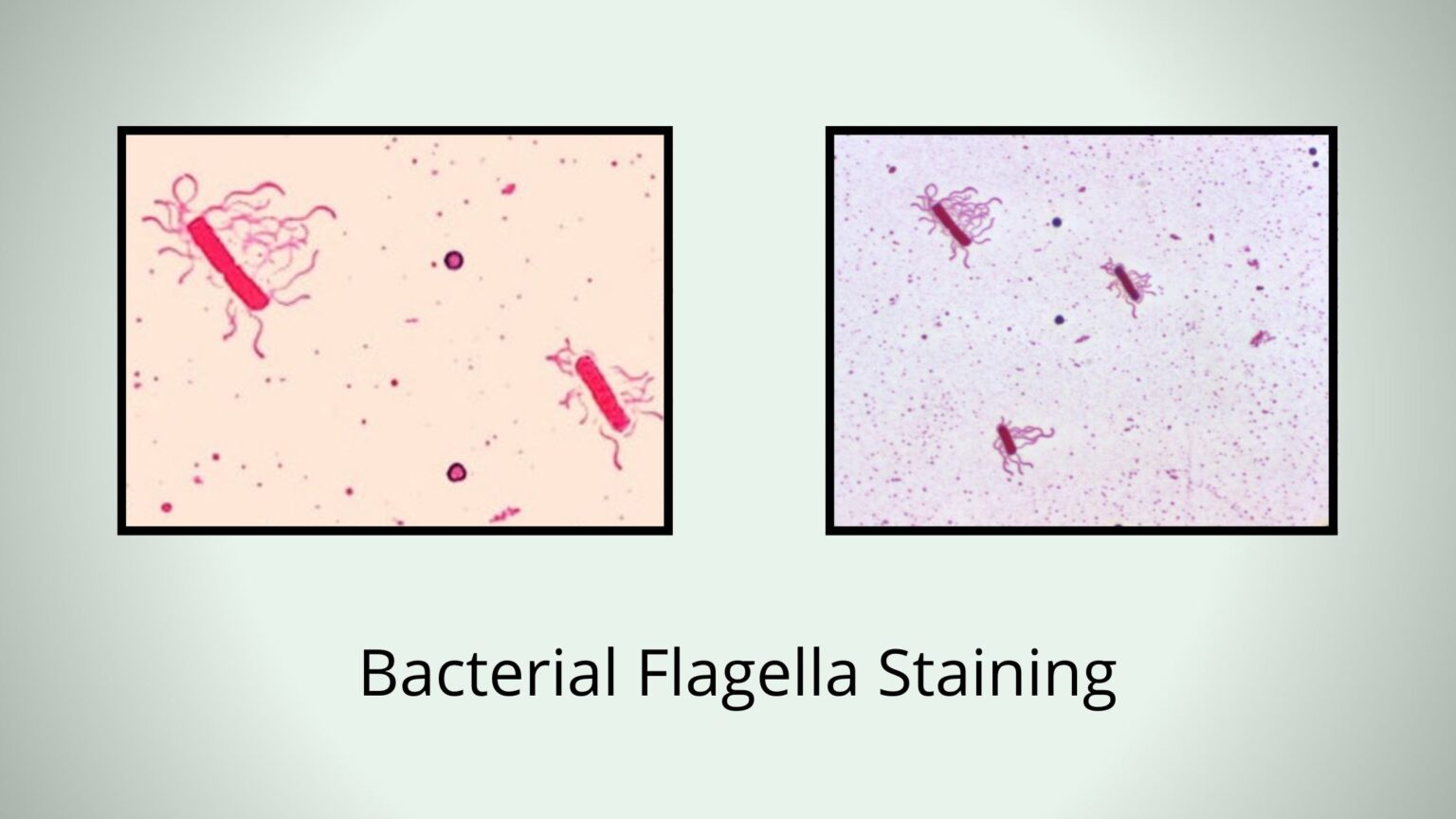 Periodic Acid-Schiff (PAS) Staining - Principle, Procedure, result ...