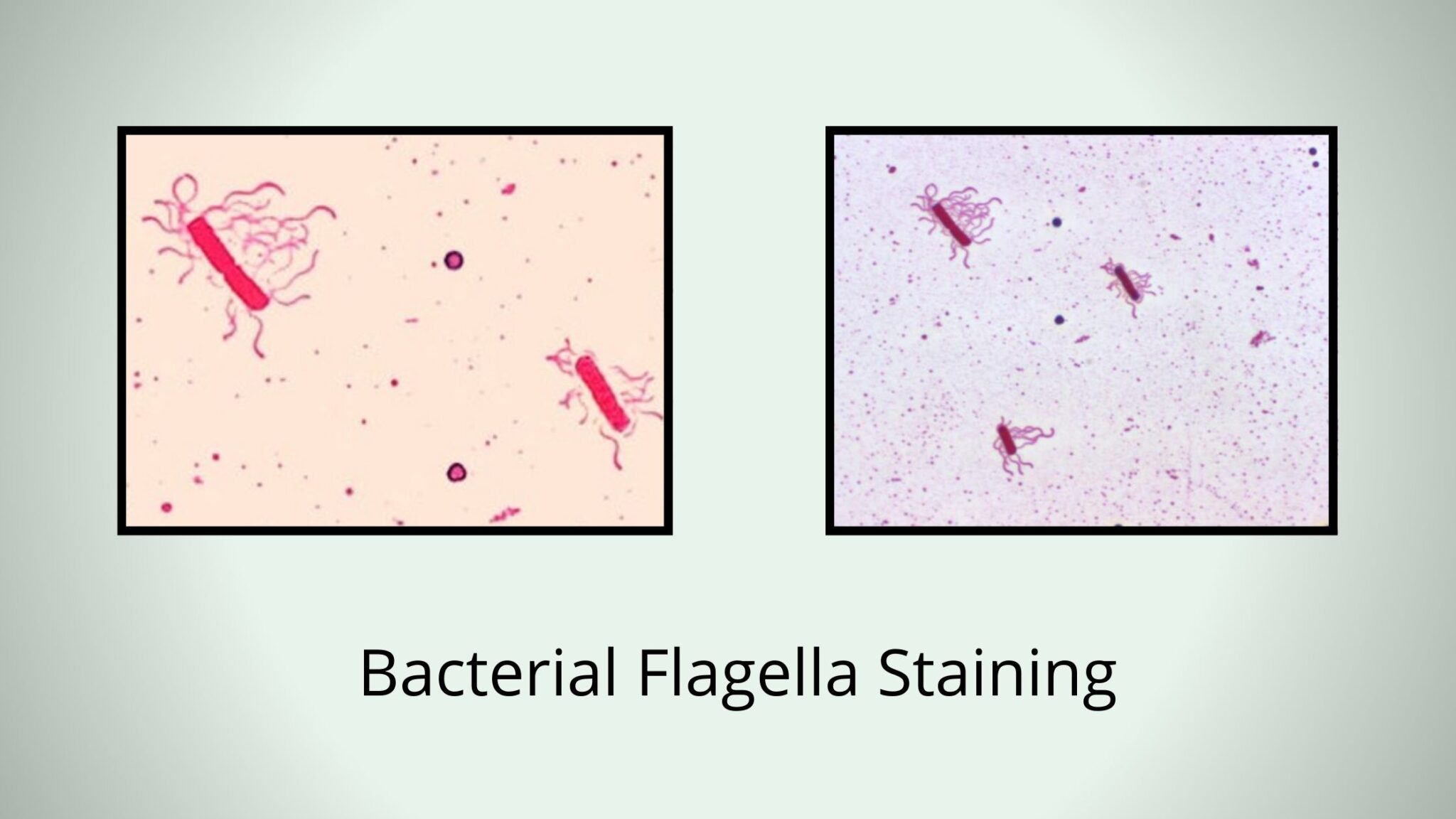 Periodic Acid-Schiff (PAS) Staining - Principle, Procedure, result ...