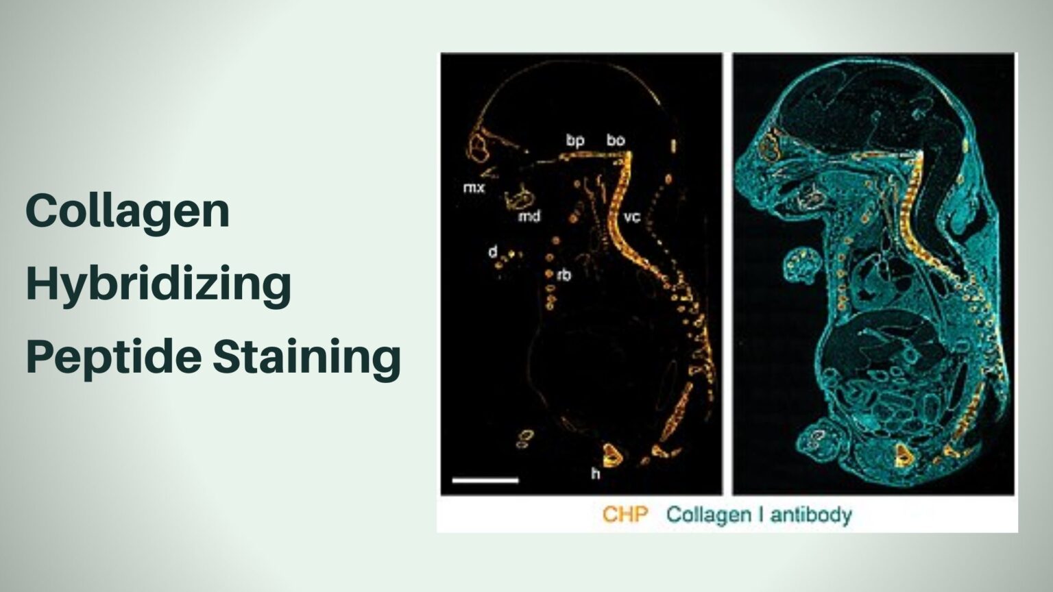 Romanowsky Stains - Principle, Types, Applications - Biology Notes Online