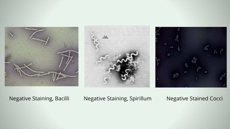 Negative Staining - Principle, Procedure, Result - Biology Notes Online Negative Staining - Principle, Procedure, Result - Biology Notes Online