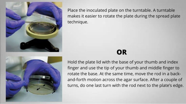 Spread plate method Procedure Principle Purpose Result