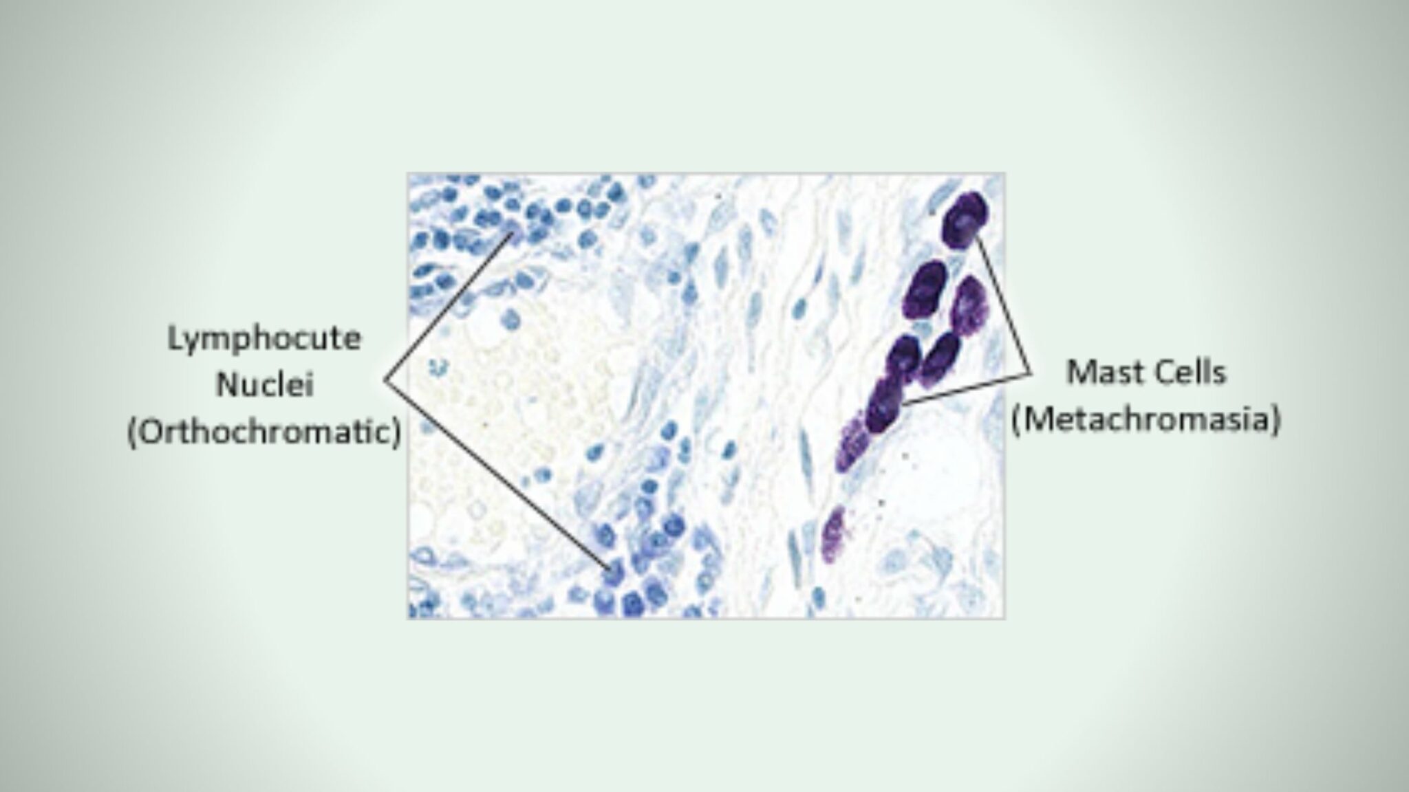 Hematoxylin and Eosin (H&E) Staining - Principle, Procedure, Result ...