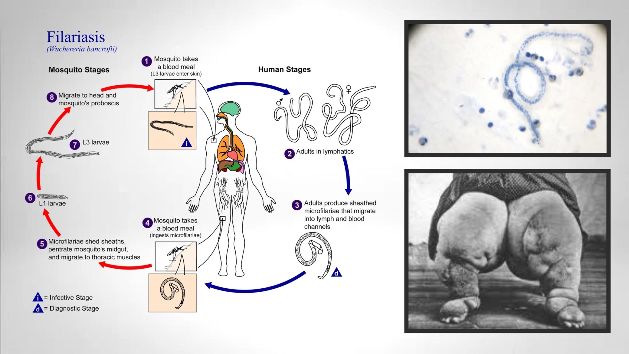 Lymphatic filariasis Archives - Biology Notes Online