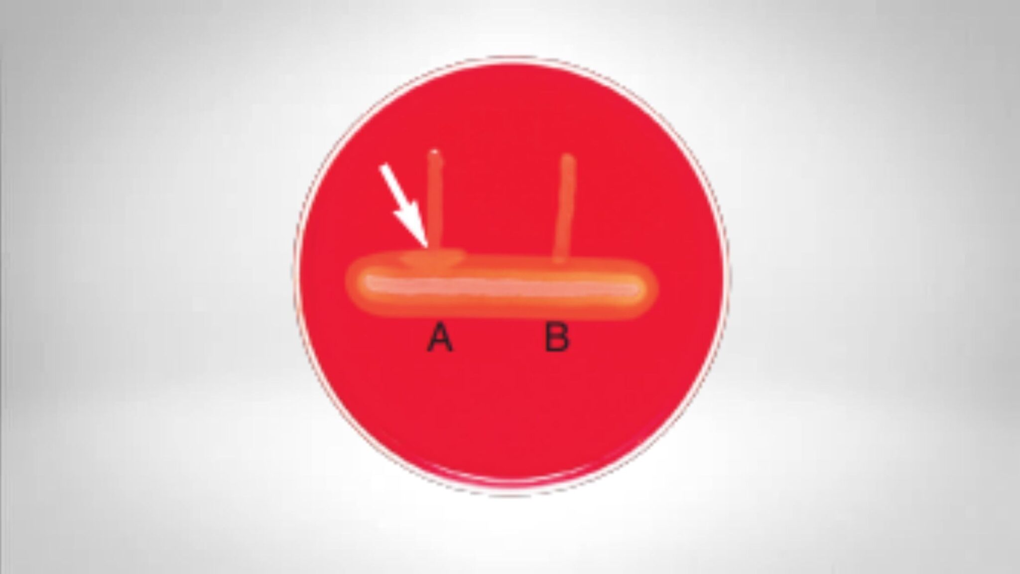 CAMP Test - Principle, Procedure, Result - Biology Notes Online