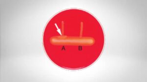 CAMP Test - Principle, Procedure, Result - Biology Notes Online