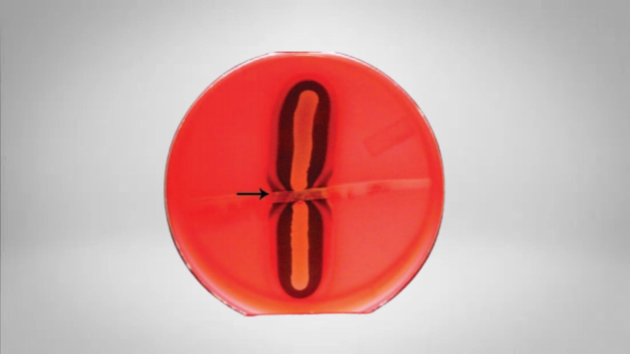 Reverse CAMP test - Principle, Procedure, Result, Uses - Biology Notes ...