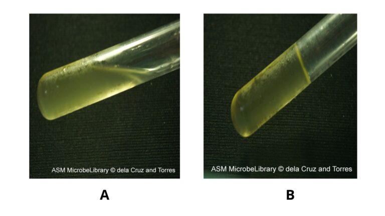 Gelatin Hydrolysis Test - Purpose, Principle, Procedure, Result ...