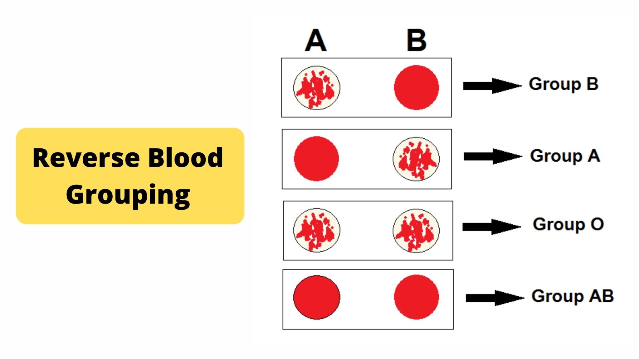 Blood Grouping Test - Principle, Procedure, Result - Biology Notes Online