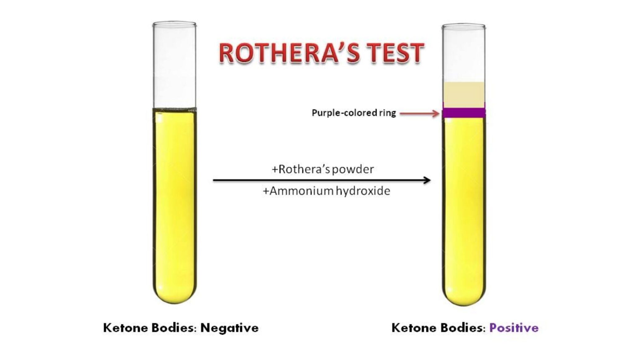 Rothera's test - Definition, Principle, Procedure, Result - Biology ...