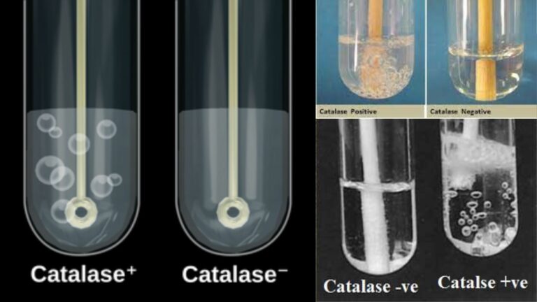 Catalase Test Principle, Procedure, Result and Application. - Biology ...