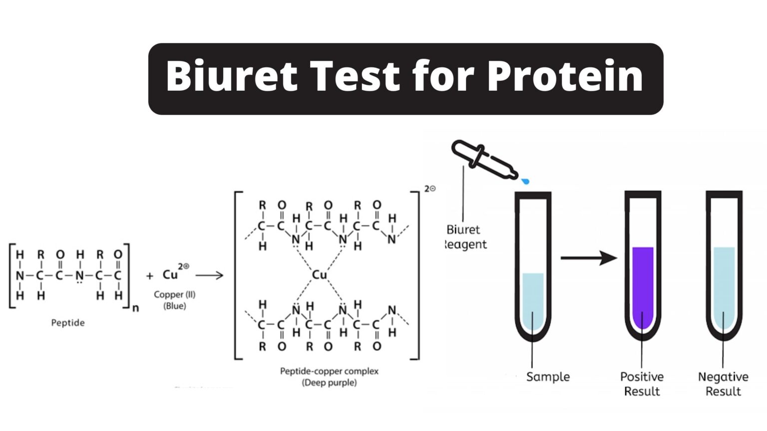 Rothera's test - Definition, Principle, Procedure, Result - Biology ...