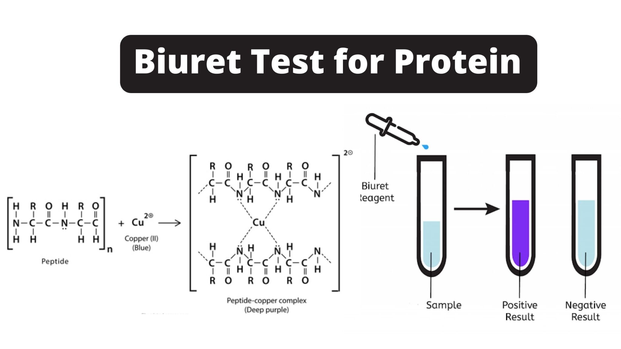 Nitrate Reduction Test - Procedure, Principle, Result - Biology Notes ...