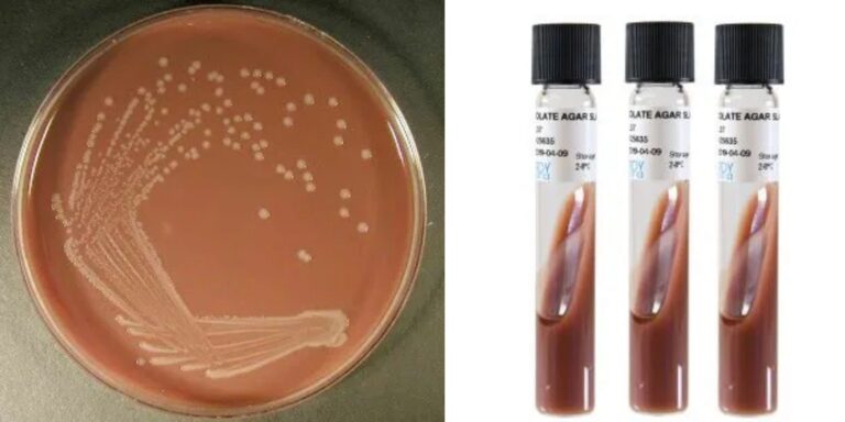 Brucella Agar - Composition, Principle, Preparation, Results, Uses ...