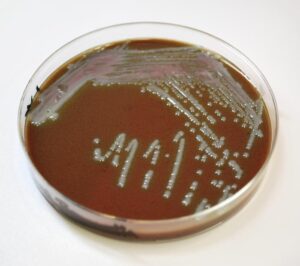 Chocolate Agar Media - Principle, Composition, Preparation, Result ...