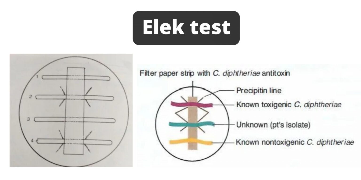 Erythrocyte Sedimentation Rate (ESR): Principle, Methods - Biology ...