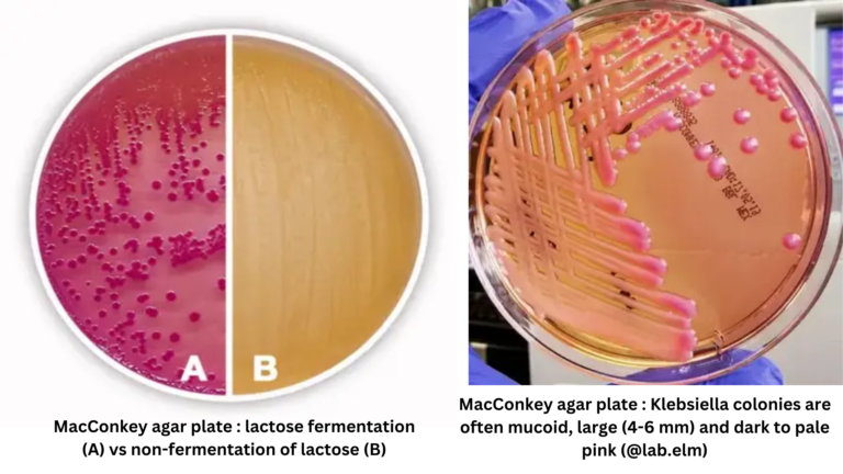 MacConkey Agar - Composition, Uses, Colony Characteristics - Biology ...