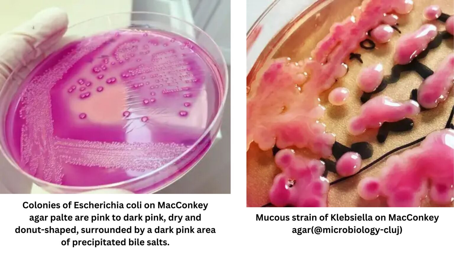MacConkey Agar - Composition, Uses, Colony Characteristics - Biology ...