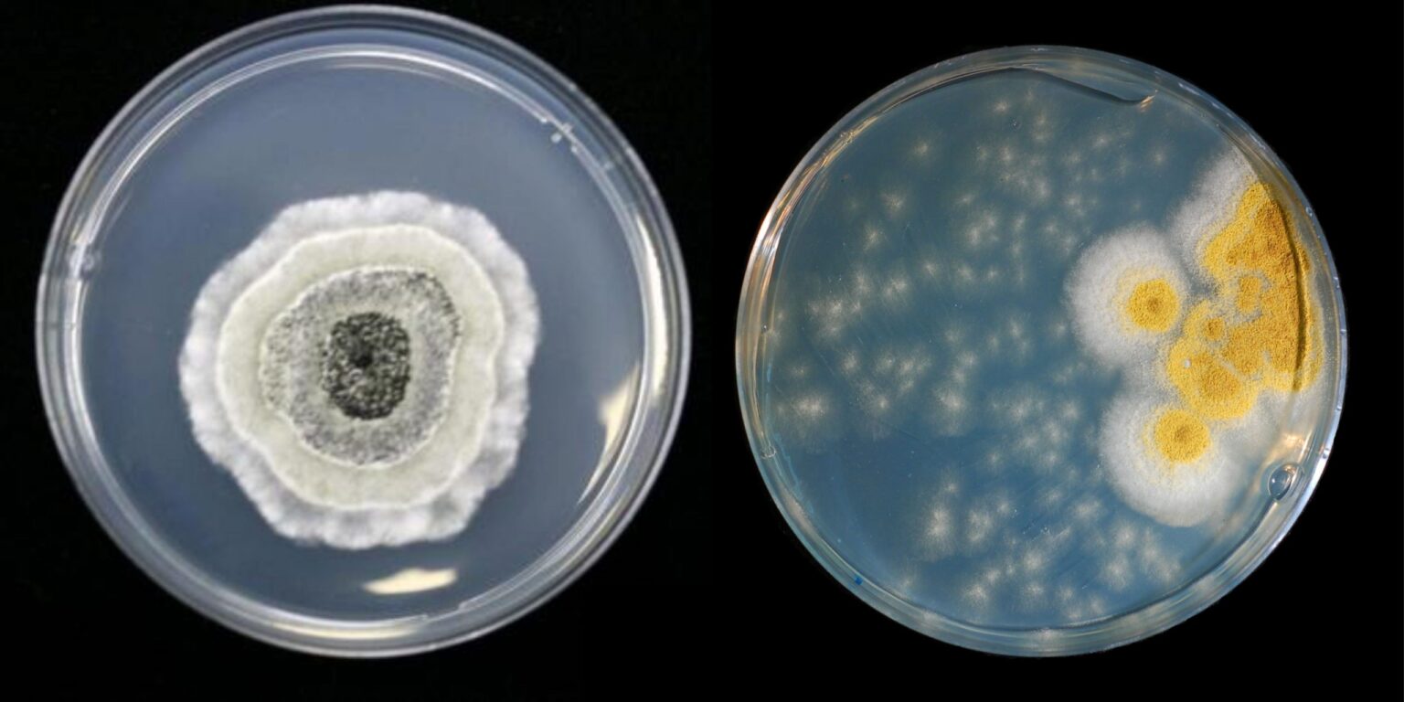 BCYE Agar - Composition, Principle, Preparation, Results, Uses ...