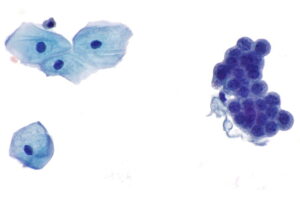 Papanicolaou Staining (Pap stain) - Principle, Procedure, Results ...