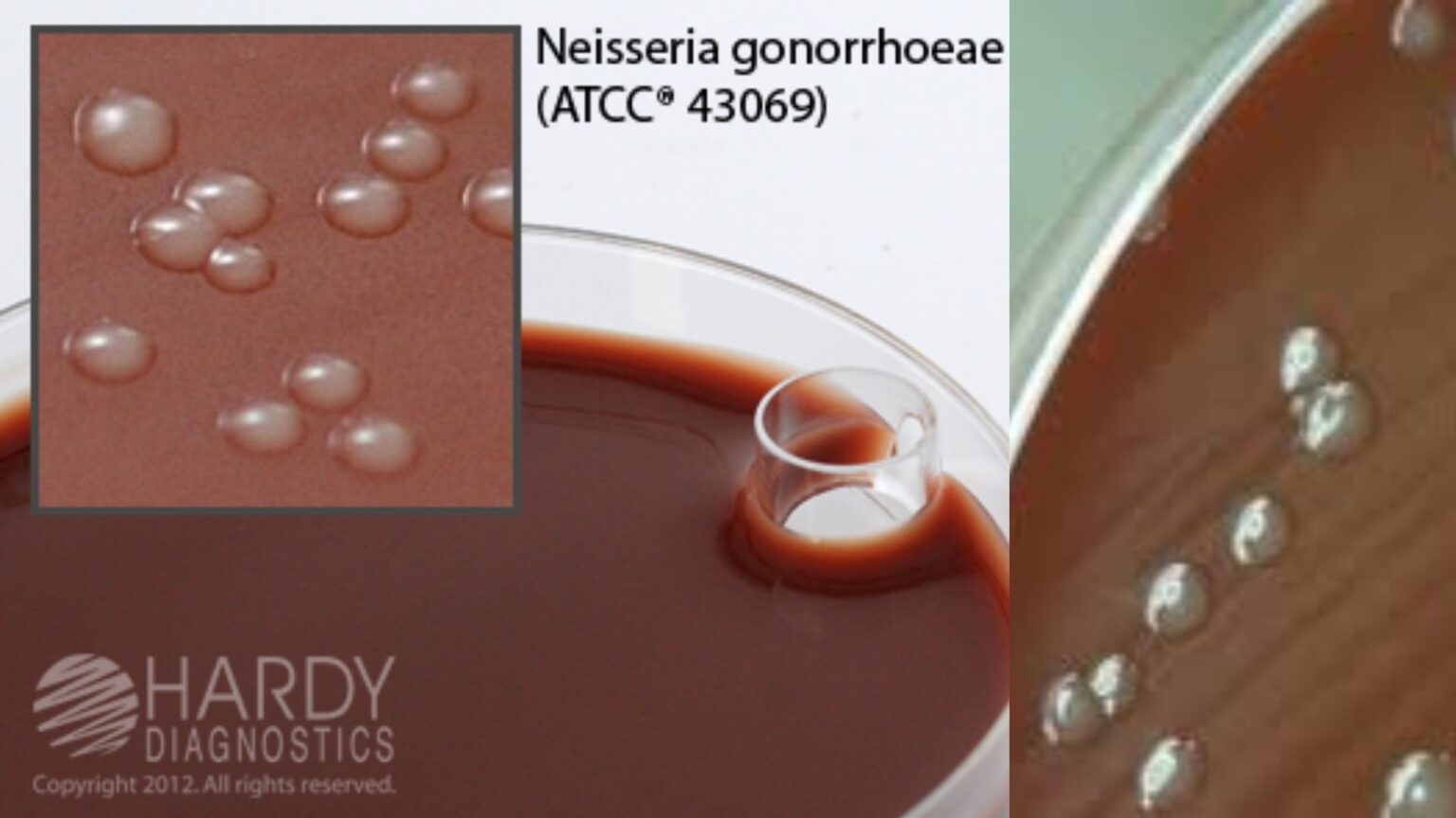 Brain Heart Infusion (BHI) Agar - Composition, Principle, Preparation ...
