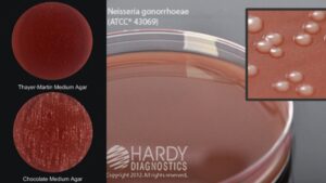 Triple Sugar Iron (TSI) Agar - Composition, Principle, Preparation ...