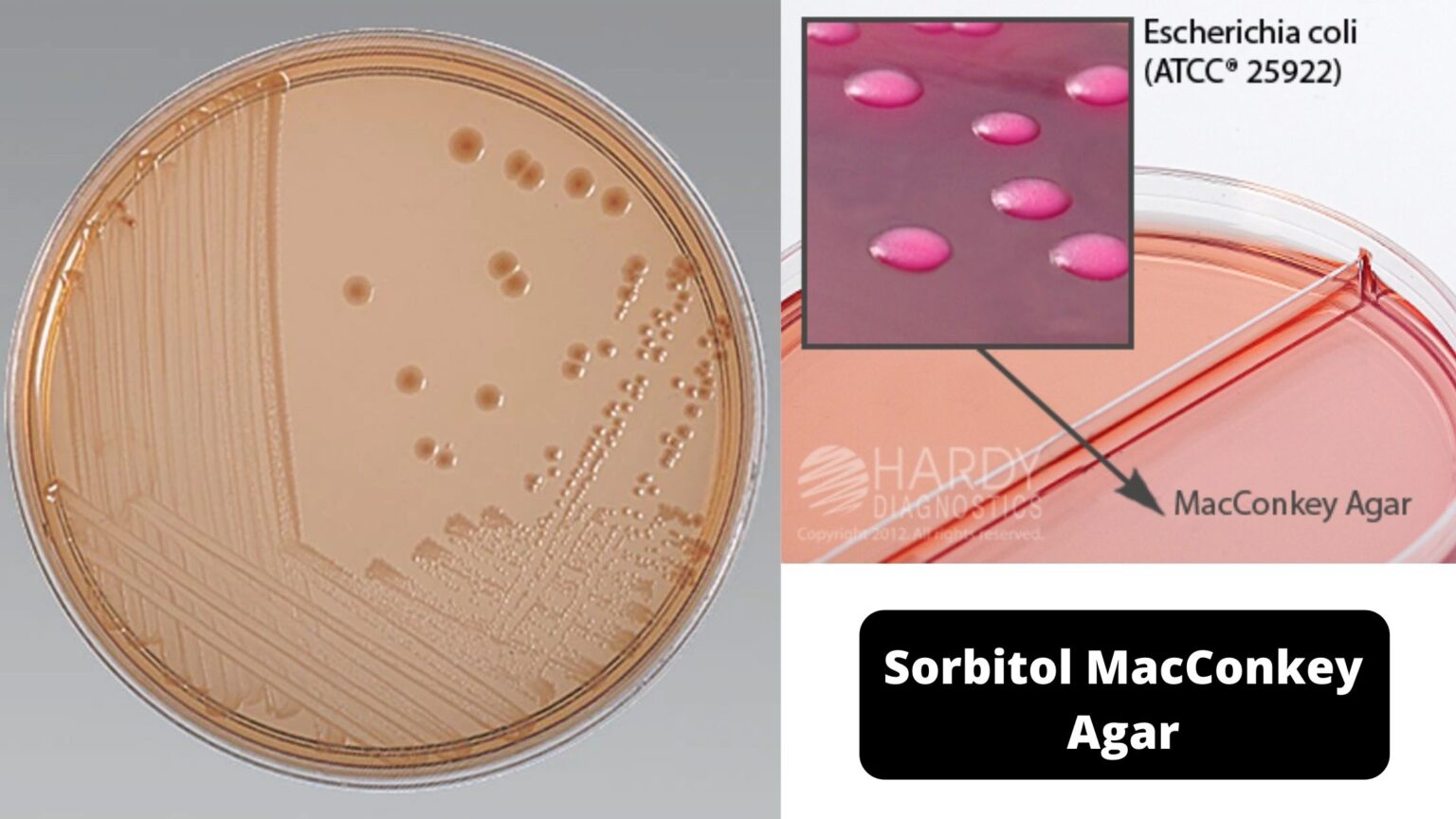 Tryptic Soy Agar (TSA) - Composition, Principle, Preparation, Results ...