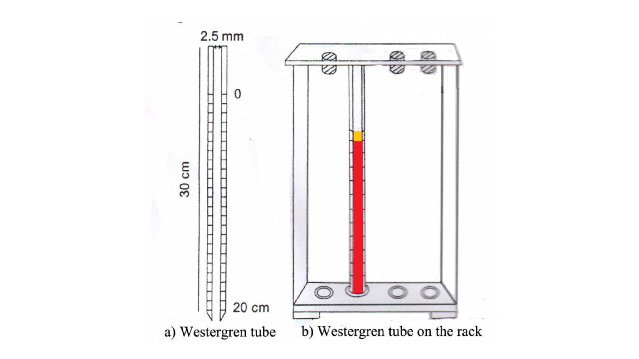 Erythrocyte Sedimentation Rate Esr Principle Methods Biology