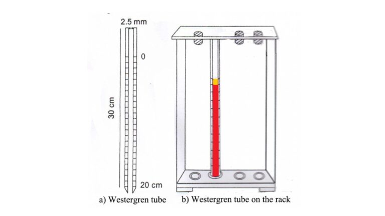 Erythrocyte Sedimentation Rate (ESR): Principle, Methods - Biology ...