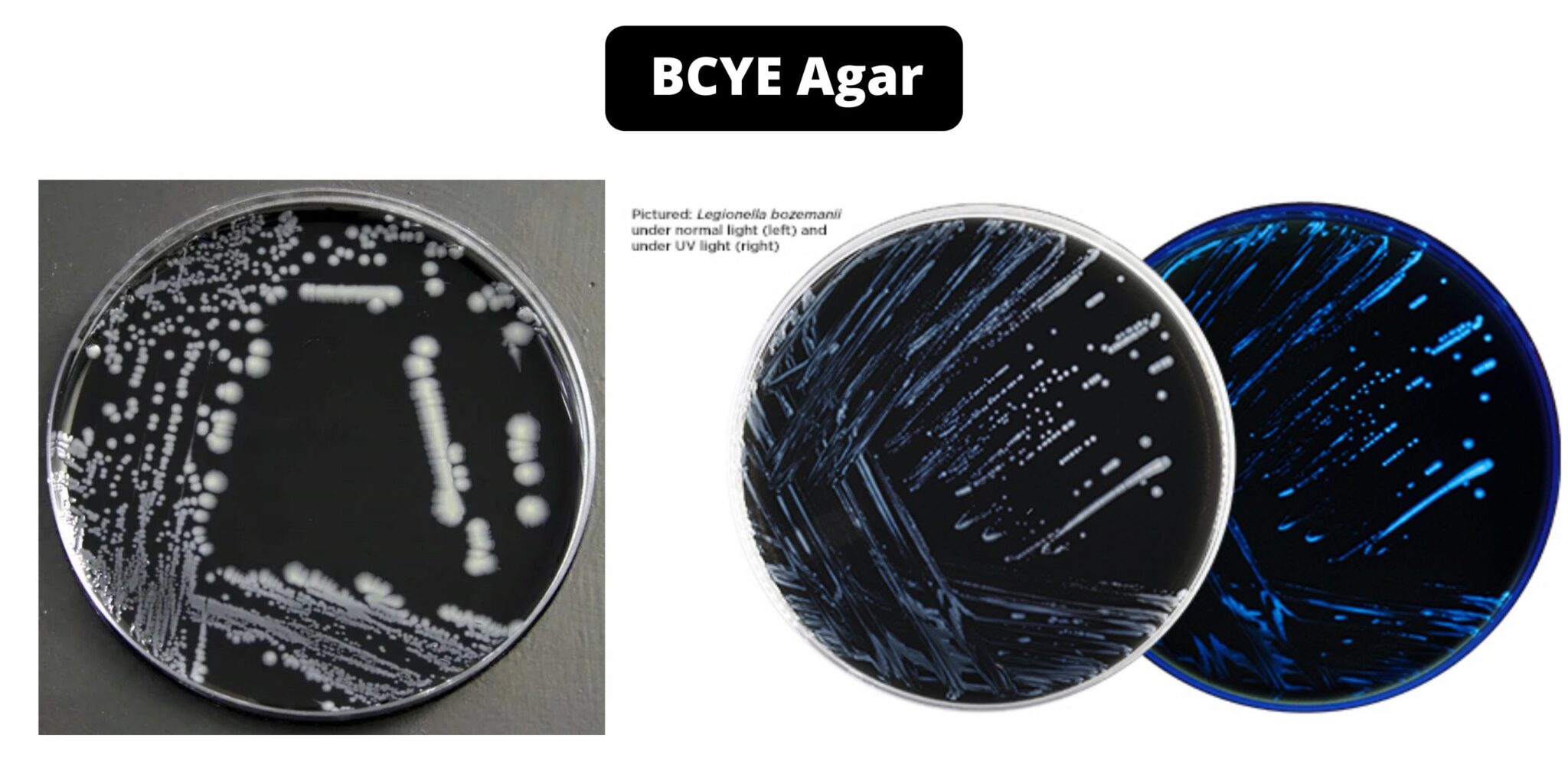 Tryptic Soy Agar (TSA) - Composition, Principle, Preparation, Results ...