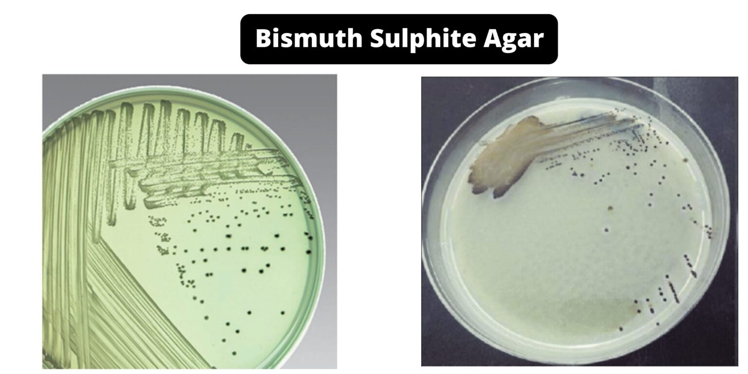 CLED Agar - Composition, Principle, Preparation, Results, Uses ...