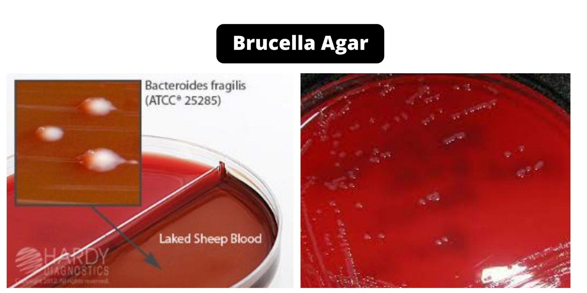 TCBS Agar - Composition, Principle, Preparation, Results, Uses ...