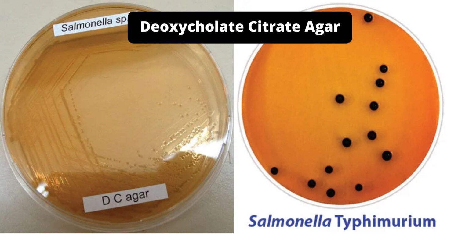 Simmons Citrate Agar - Composition, Principle, Preparation, Results ...
