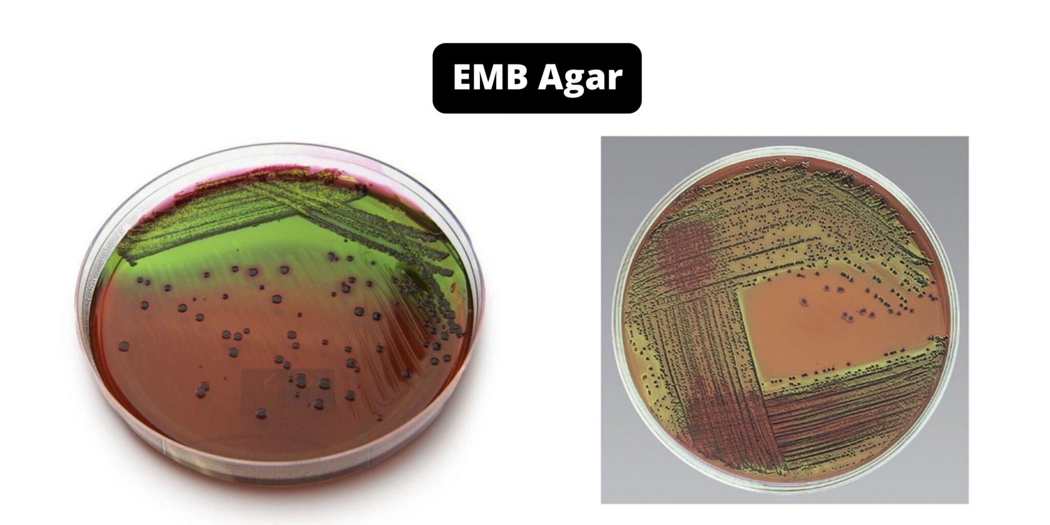 Endo Agar - Composition, Principle, Preparation, Results, Uses ...