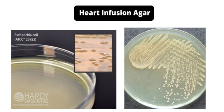 Nutrient Agar - Principle, Composition, Preparation, Results, Uses ...