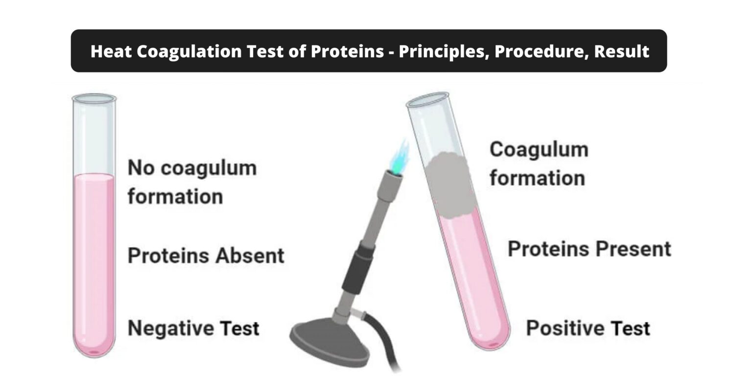 Urease Test - Principle, Procedure, Result - Biology Notes Online