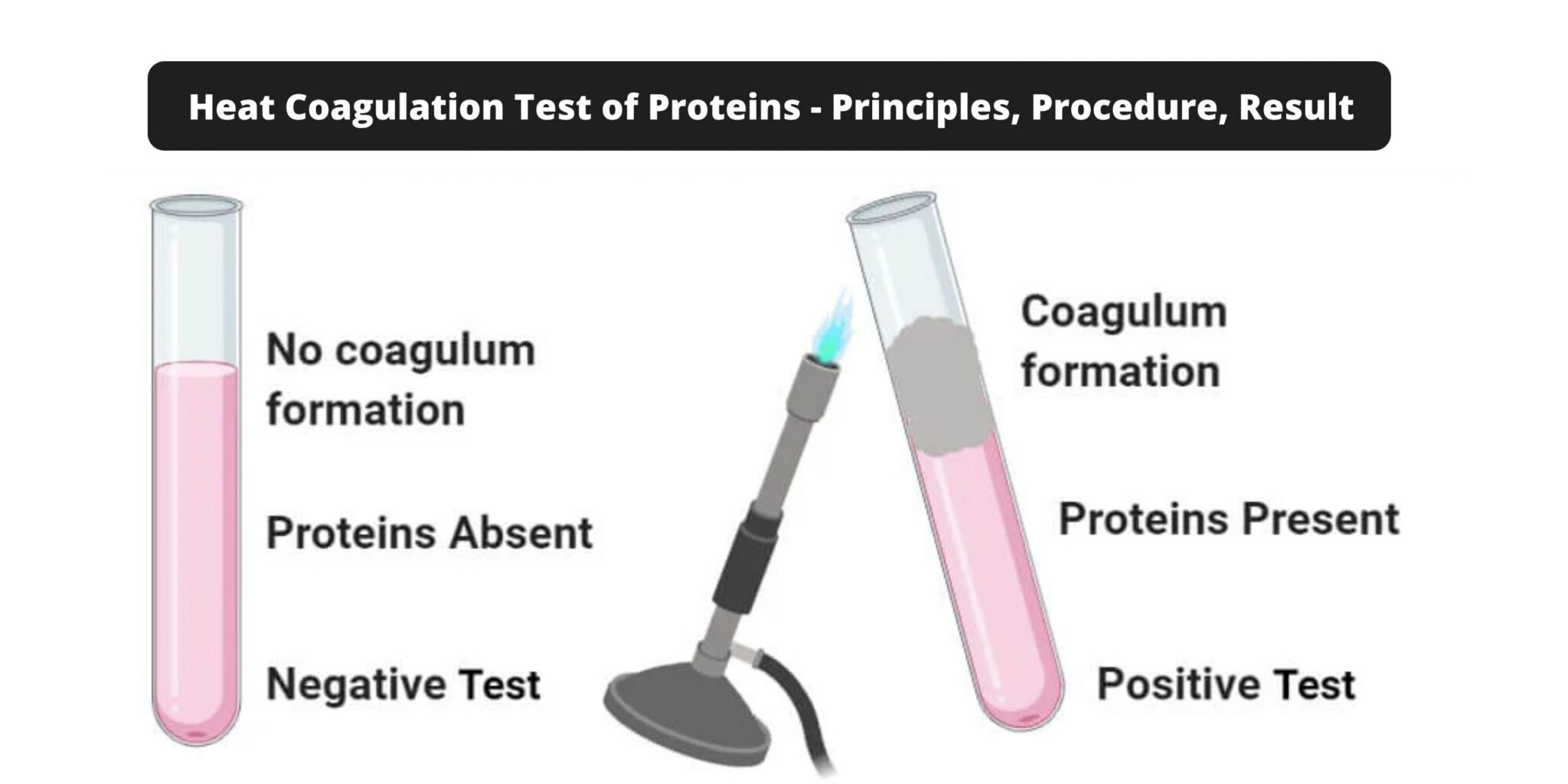 Gelatin Hydrolysis Test - Purpose, Principle, Procedure, Result ...