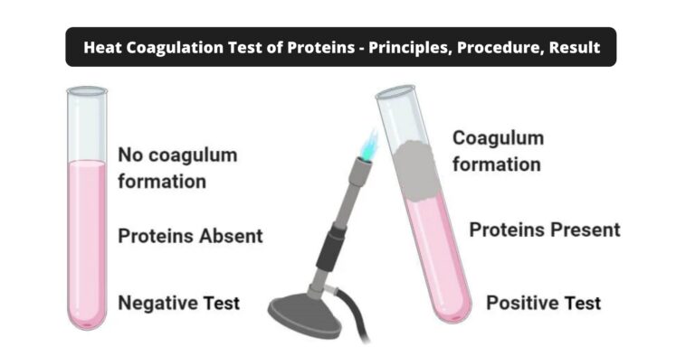 Urease Test - Principle, Procedure, Result - Biology Notes Online