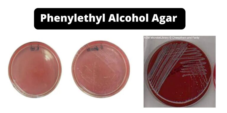 Deoxycholate Citrate Agar (DCA) - Composition, Principle, Preparation ...