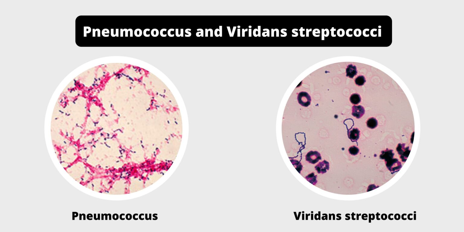 Comparison Between Acid Fast and Non Acid Fast Bacteria - Biology Notes ...
