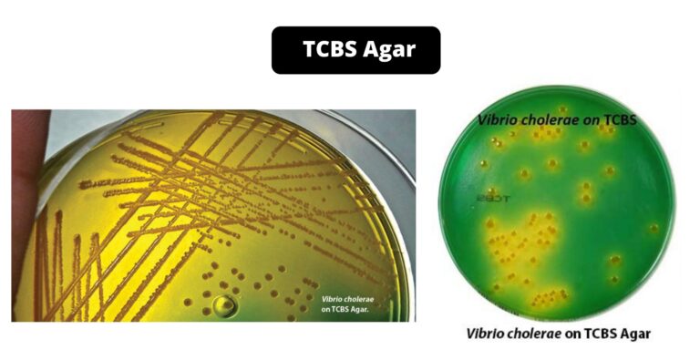 Nutrient Agar - Principle, Composition, Preparation, Results, Uses ...