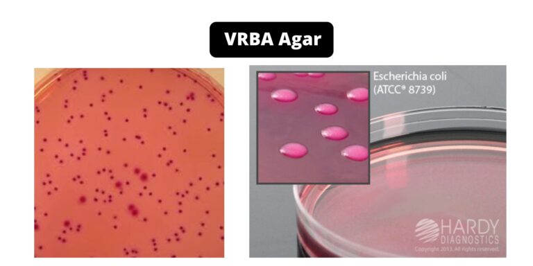 CLED Agar - Composition, Principle, Preparation, Results, Uses ...