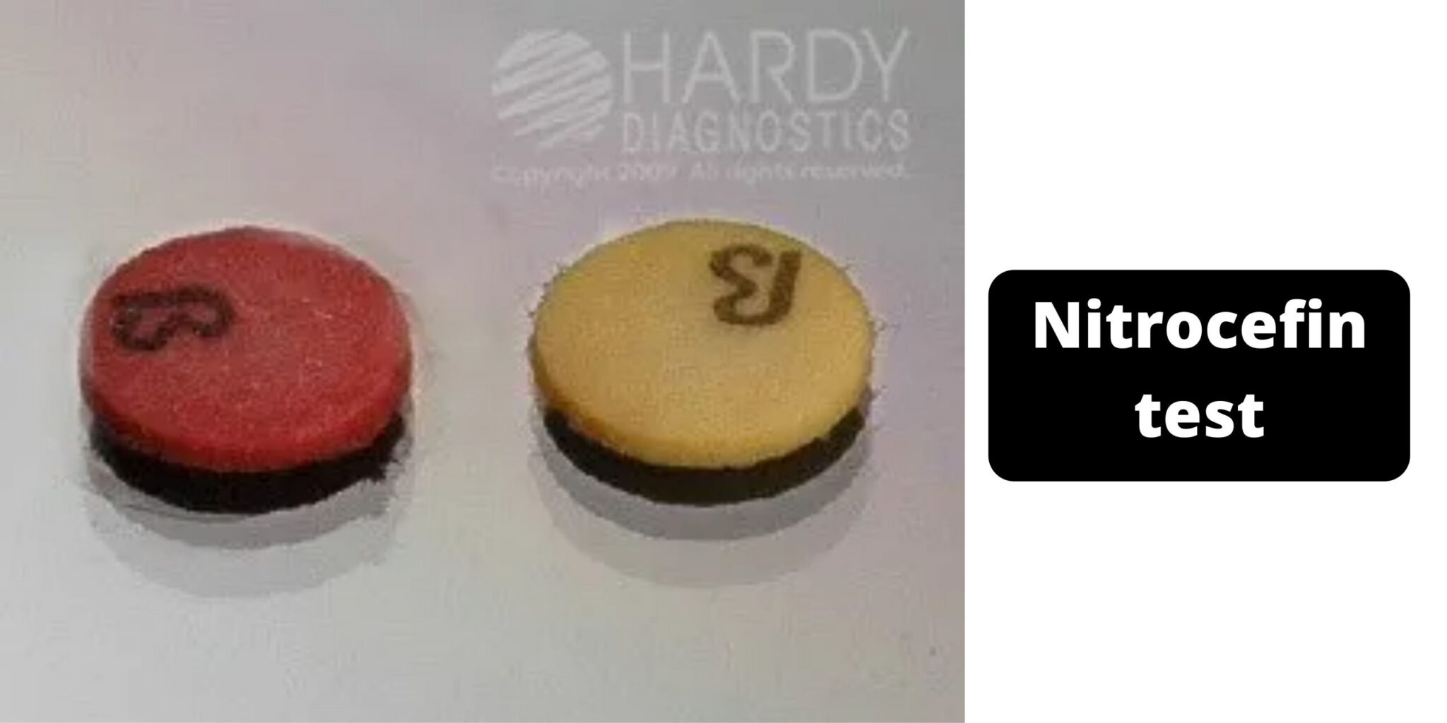 Reverse CAMP test Principle, Procedure, Result - Biology Notes Online