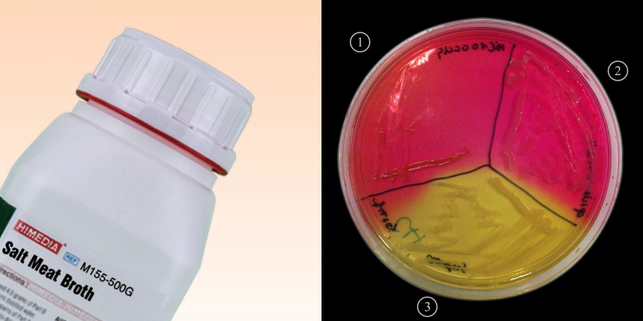 Lactobacilli MRS Broth and Agar - Composition, Preparation, Principle ...