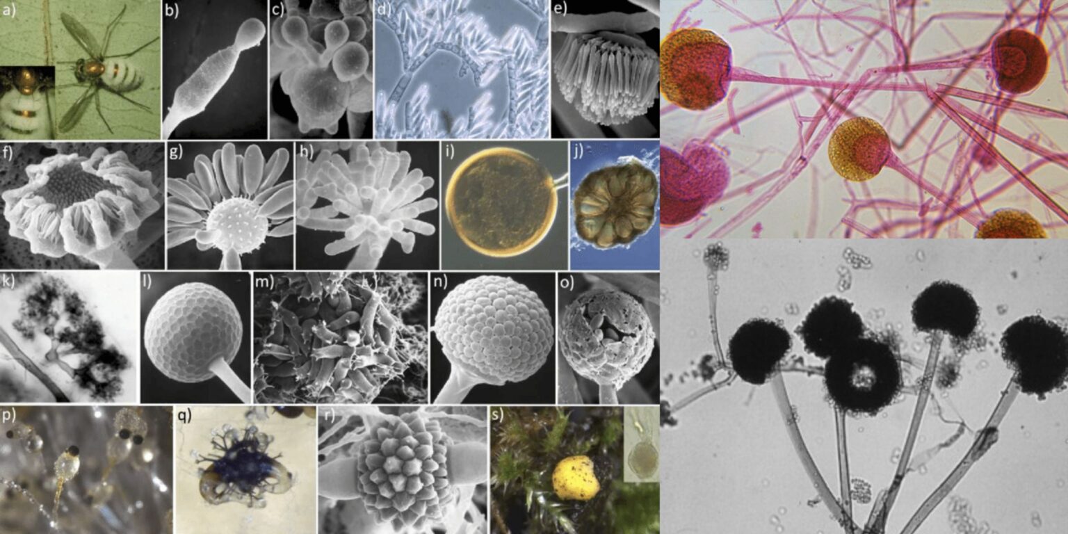 Cryptococcus neoformans - Structure, Infection, Habitat - Biology Notes ...
