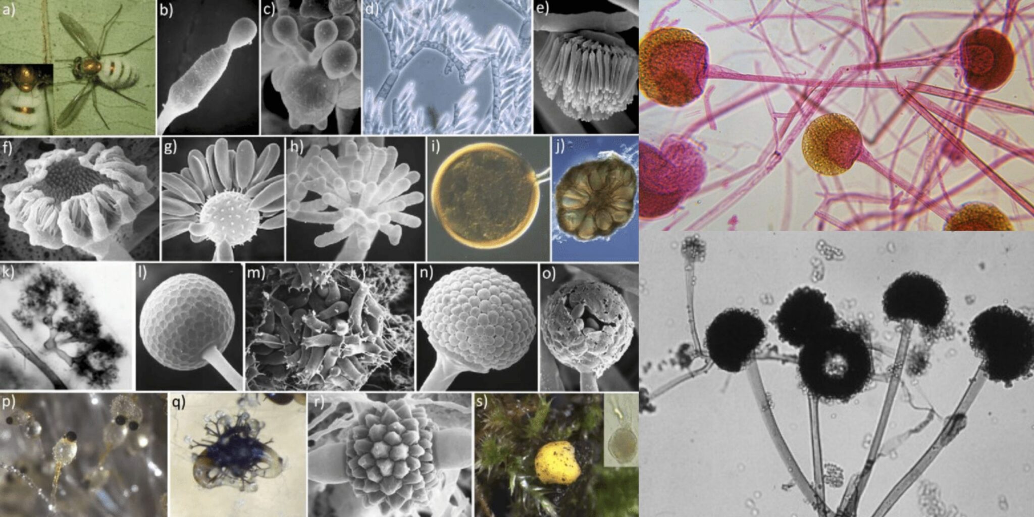 Cryptococcus neoformans - Structure, Infection, Habitat - Biology Notes ...